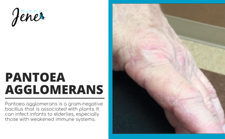 Causes Of Pantoea Agglomerans And It's Treatments